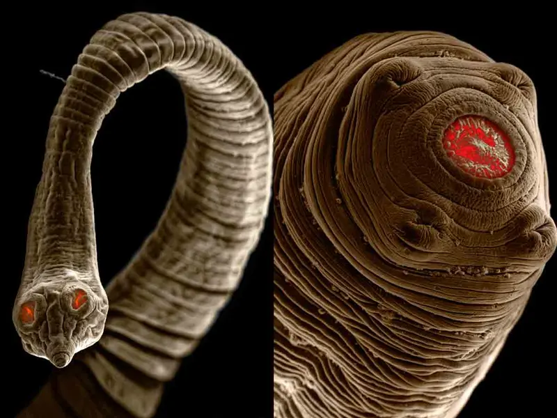 Científicos muestran espeluznantes imágenes de parásitos intestinales ...